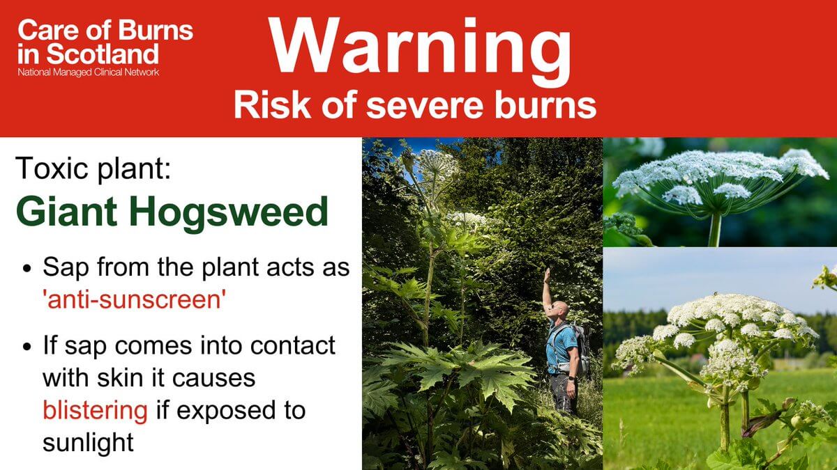 Giant Hogweed in Scotland - Staying Safe